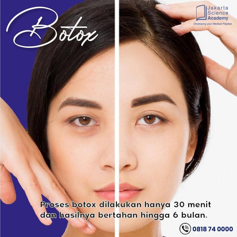 Apa itu Suntik Botox? Manfaat dan Efek Sampingnya : Jakarta Science Academy